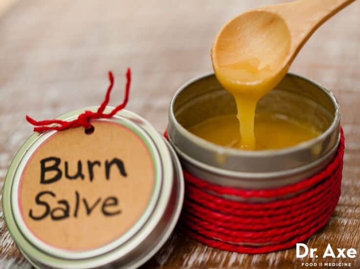 Homemade Burn Salve