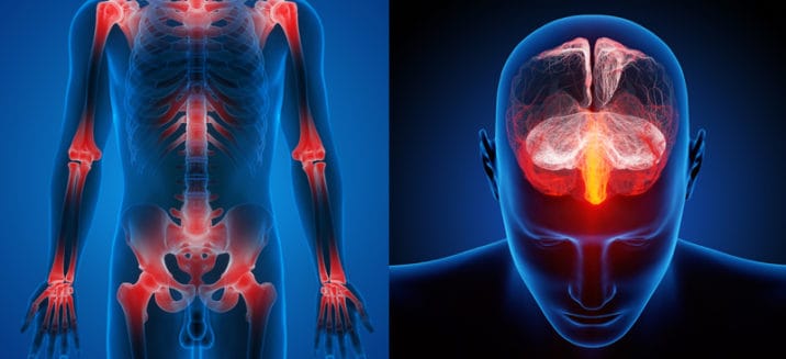 What Is Inflammation? Symptoms, Causes & Natural Remedies - Dr. Axe