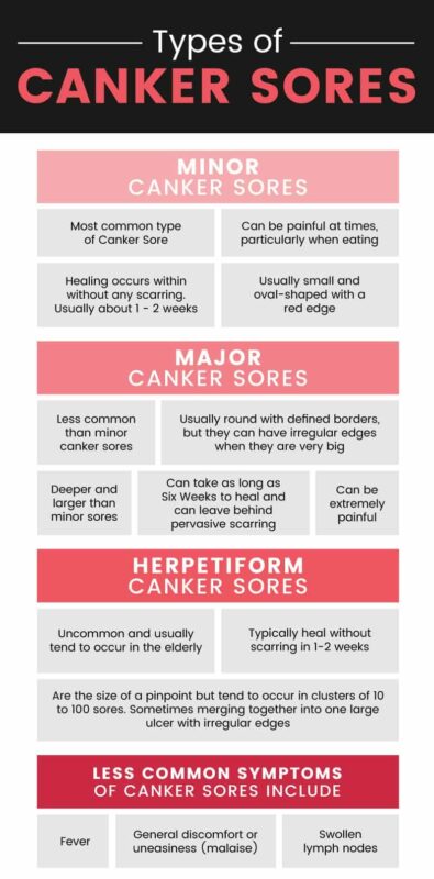 Canker Sore Symptoms, Causes and Natural Remedies - Dr. Axe