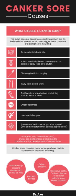 Canker Sore Symptoms, Causes and Natural Remedies - Dr. Axe