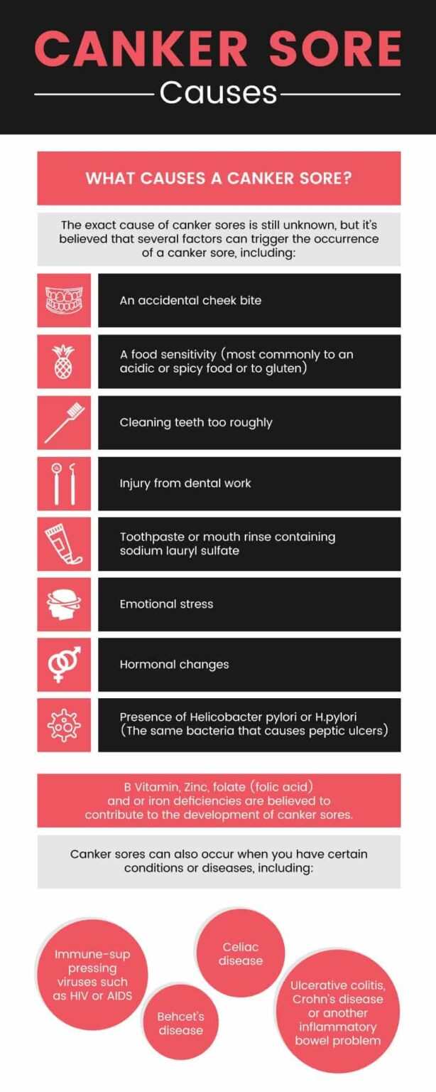 Canker Sore Symptoms, Causes and Natural Remedies - Dr. Axe