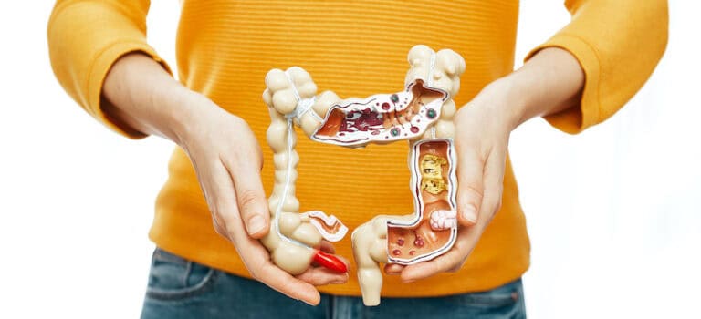 Flatulence Causes, Home Remedies, Treatment and More on Farts - Dr. Axe