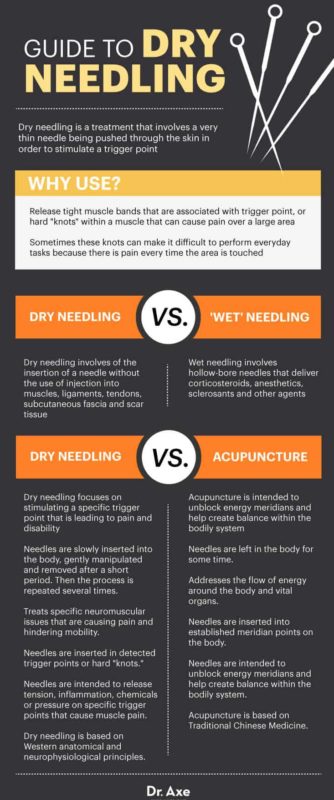 Dry Needling Benefits for Muscle Pain Relief and Headaches - Dr. Axe