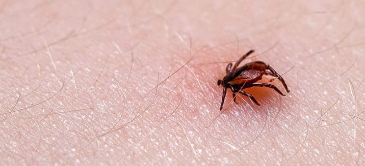 Lyme Disease Symptoms, Causes and Facts - Dr. Axe