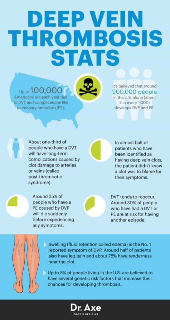 Deep Vein Thrombosis Causes, Risk Factors & Natural Remedies - Dr. Axe