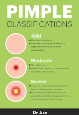 How to Get Rid of Pimples the Natural Way - Dr. Axe