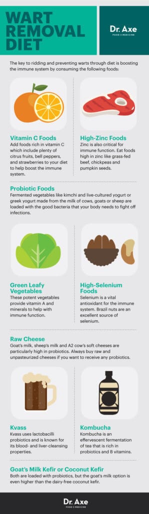 How to Get Rid of Warts Naturally + Wart Symptoms, Causes - Dr. Axe