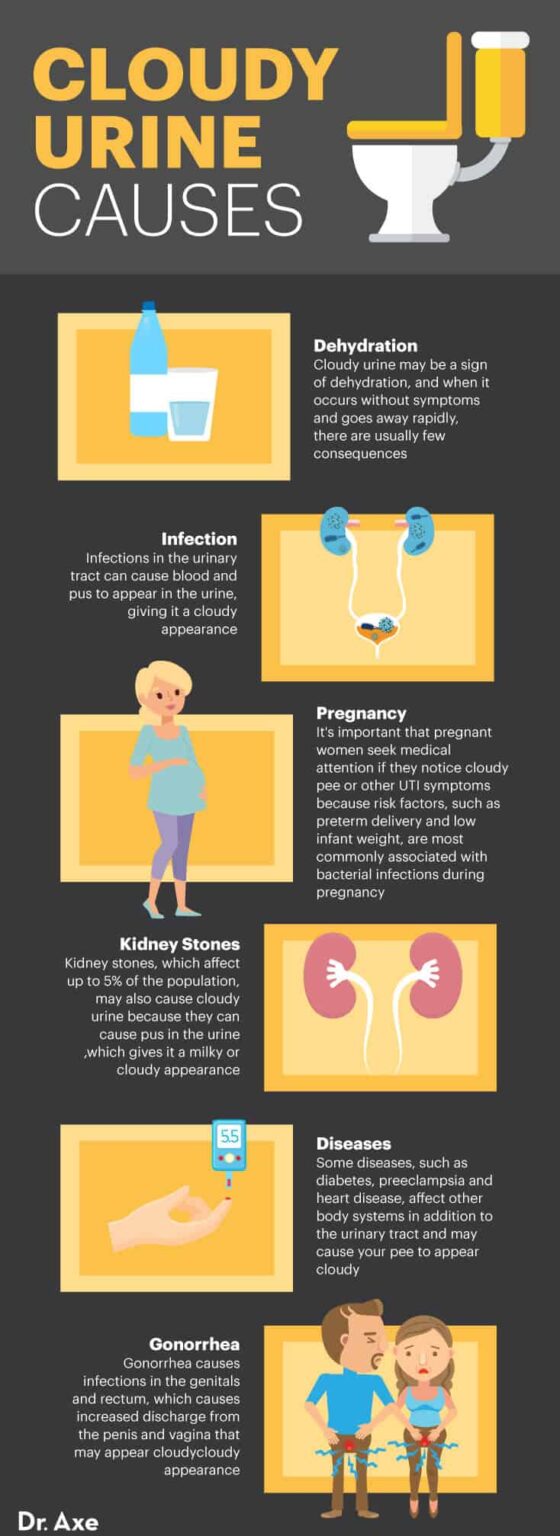 Cloudy Urine Causes, Diagnosis and Natural Remedies - Dr. Axe