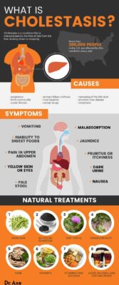 Cholestasis Symptoms, Causes, Treatment, in Pregnancy, More - Dr. Axe
