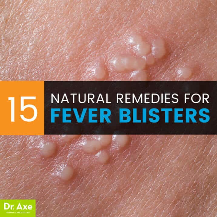 Fever Blister Causes 15 Natural Remedies Dr Axe Fever Blister Causes 15 Natural Remedies Dr Axe