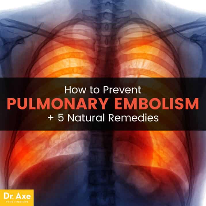 Pulmonary Embolism + 5 Natural Remedies for Prevention - Dr. Axe