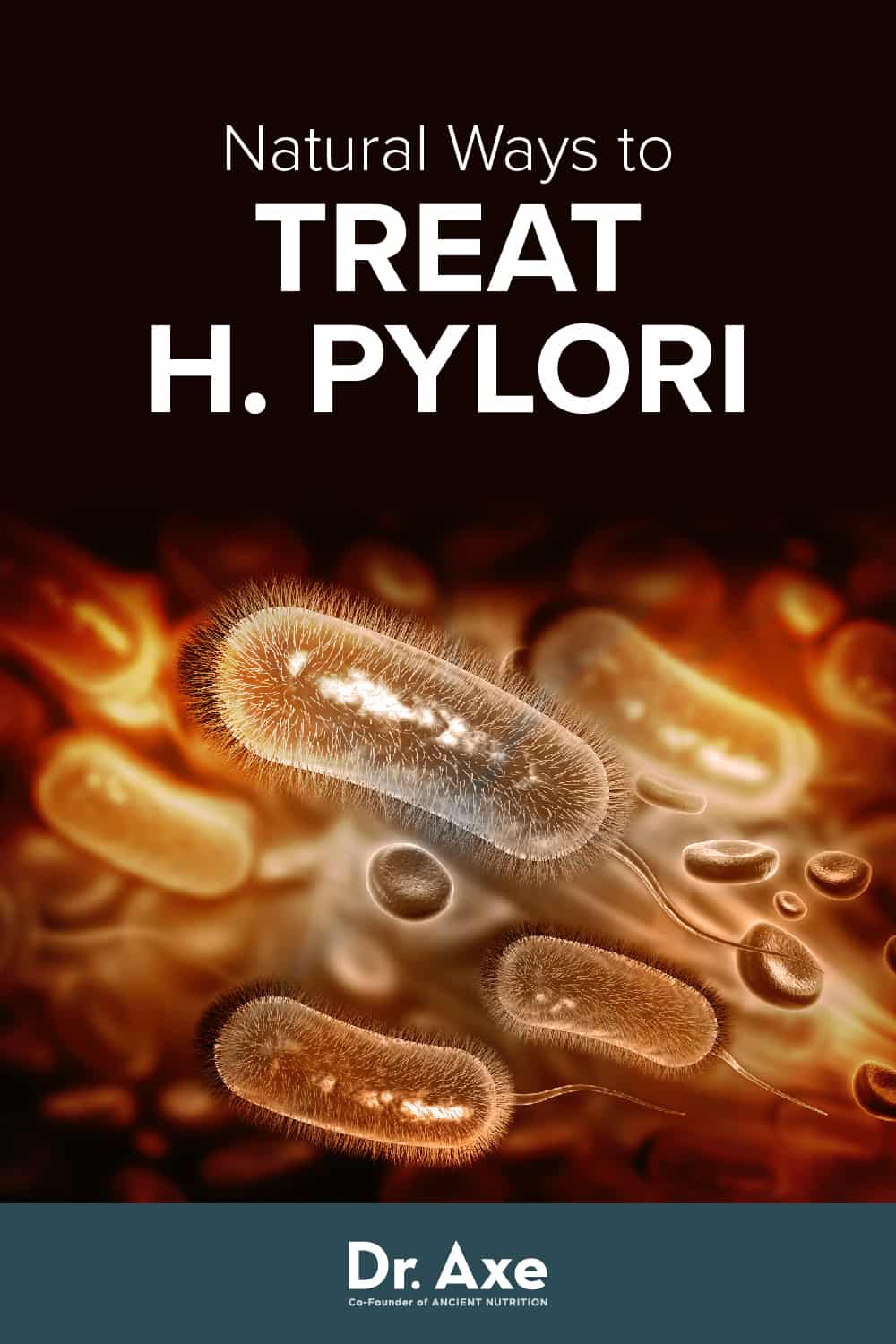 H. Pylori Natural Treatments, Symptoms, Causes, More - Dr. Axe