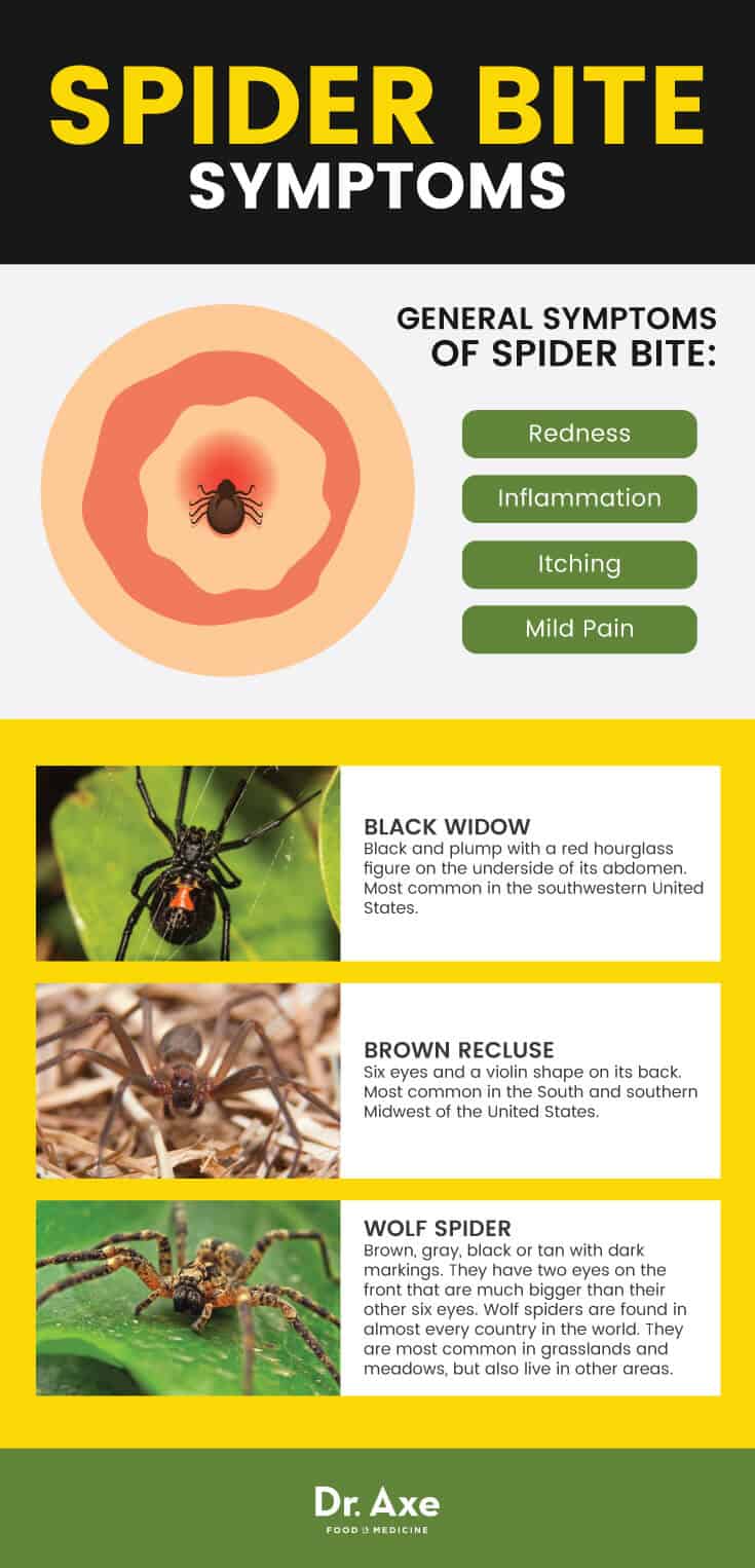 Spider Bite Symptoms How When To Treat Them At Home Dr Axe