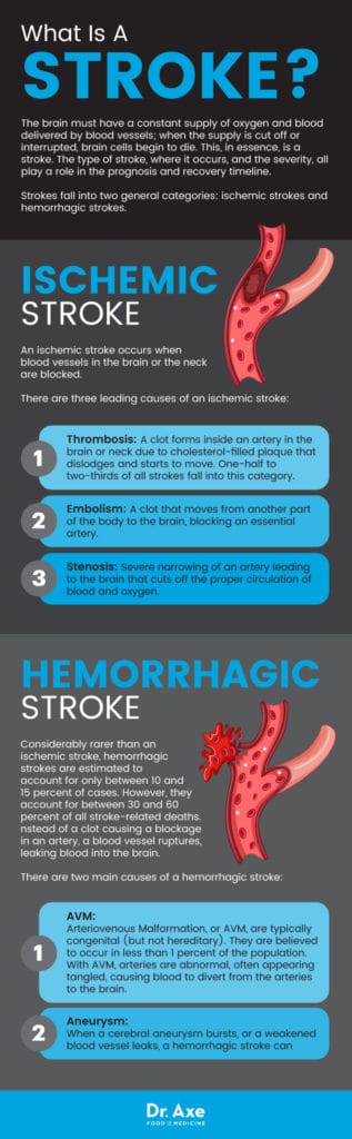 Warning Signs of a Stroke: Learn FAST + 23 More - Dr. Axe