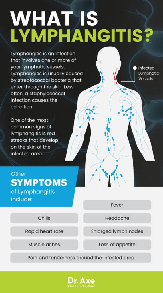 Bacterial Infection Of Lymph Nodes FIDP Bacterial Infection Of Lymph Nodes FIDP