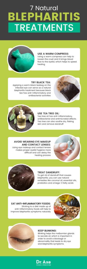 Blepharitis: 7 Natural Treatments to Soothe an Inflamed Eyelid - Dr. Axe