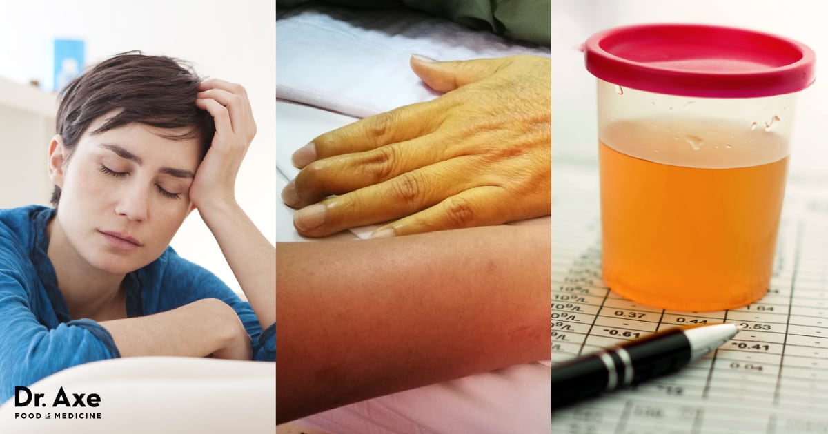 G6PD Deficiency + 4 Natural Ways to Manage Symptoms - Dr. Axe