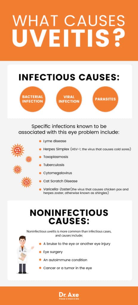 Uveitis + 7 Natural Ways to Improve Symptoms - Dr. Axe