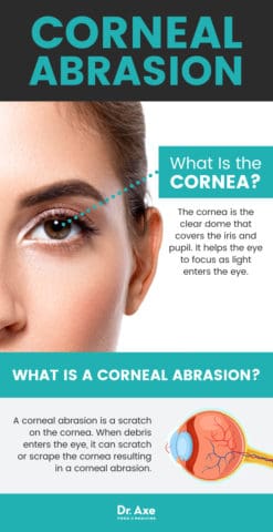 Corneal Abrasion: 6 Natural Ways to Relieve a Scratched Eye - Dr. Axe