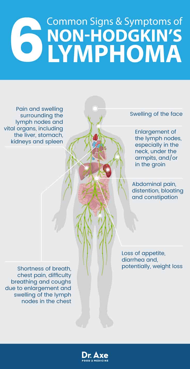 Non Hodgkin s Lymphoma Natural Symptom Management Dr Axe