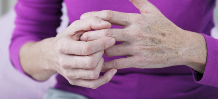 Psoriatic Arthritis: 7 Natural Ways to Relieve Symptoms - Dr. Axe