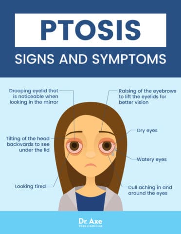 Ptosis Causes + 8 Natural Treatments for a Drooping Eyelid - Dr. Axe