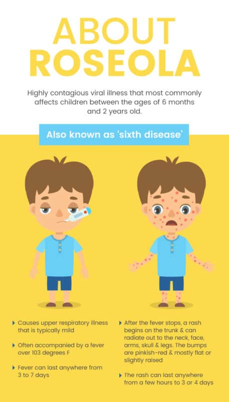 Roseola: How to Soothe 'Sixth Disease' Symptoms - Dr. Axe