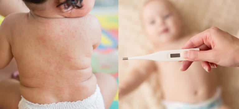 Roseola: How to Soothe 'Sixth Disease' Symptoms - Dr. Axe