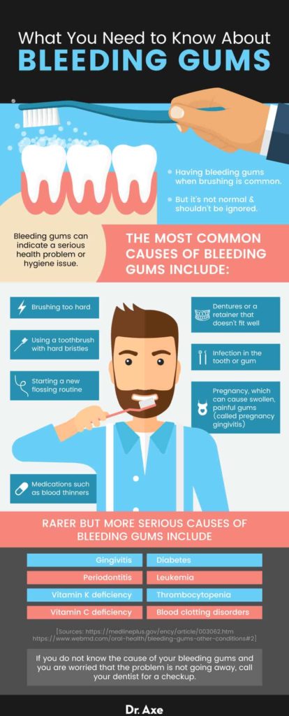 Bleeding Gums (Plus 5 Ways to Improve Gum Health) - Dr. Axe