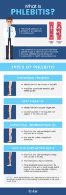 Phlebitis (5 Natural Ways to Improve Symptoms) - Dr. Axe