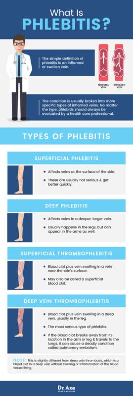 Phlebitis (5 Natural Ways to Improve Symptoms) - Dr. Axe