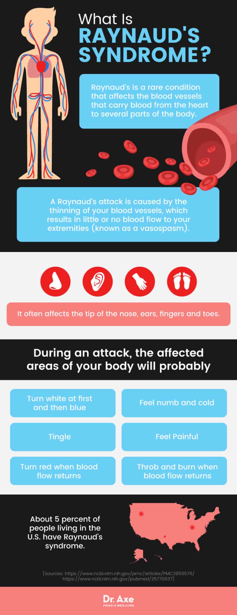 Raynaud's Syndrome + 6 Ways to Manage Symptoms - Dr. Axe