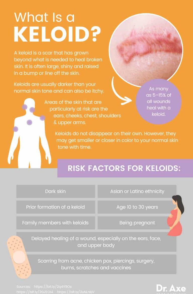 Keloid Causes, Symptoms and Common Treatments - Dr. Axe
