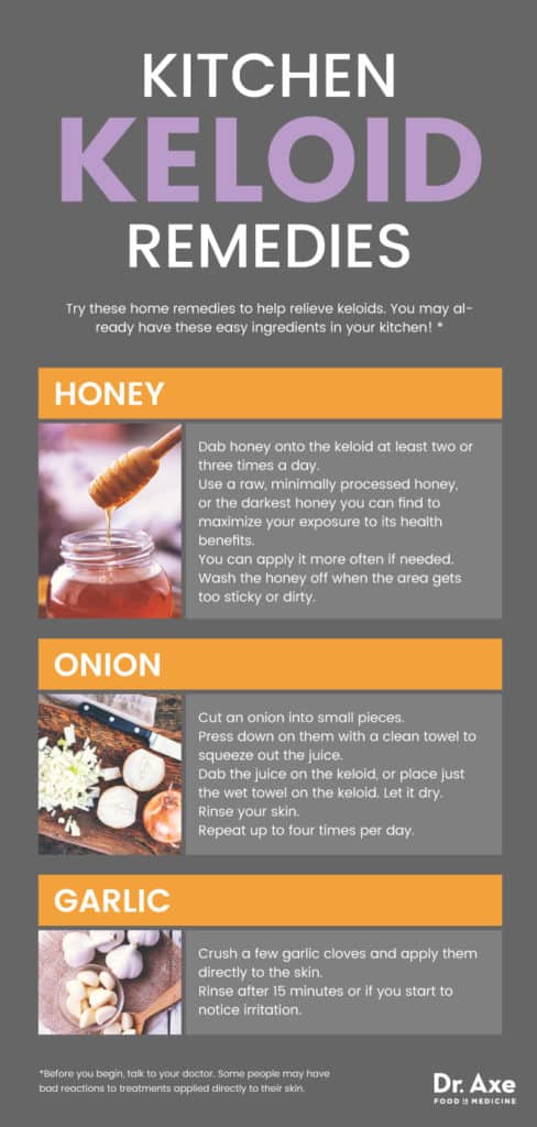 Keloid Causes (Plus, 5 Natural Tips to Help Treat Keloids) - Dr. Axe