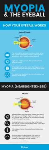 Myopia: Foods & Vitamins for Eye Health - Dr. Axe