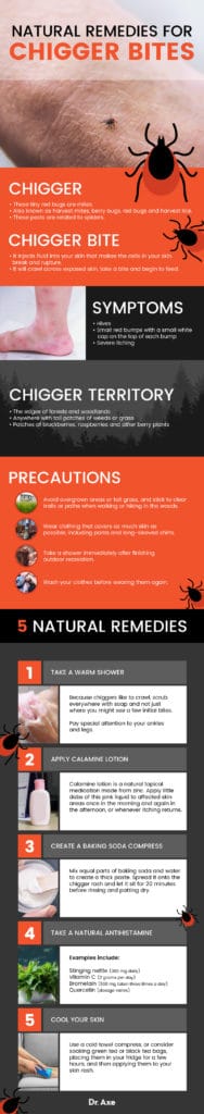 Chigger Bites: Symptoms, Causes + Natural Treatment