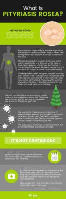 Pityriasis Rosea: 6 Natural Ways to Help Treat 'Christmas Tree' Rash