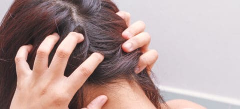 Tinea Capitis (+6 Natural Ways to Help Treat Scalp Ringworm)