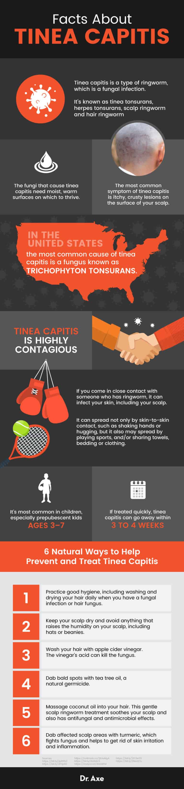 Tinea Capitis (+6 Natural Ways to Help Treat Scalp Ringworm)