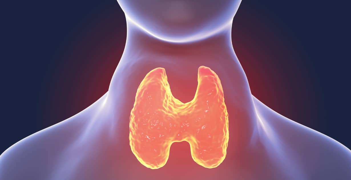 Goiter Symptoms, Risk Factors & Treatment - Dr. Axe