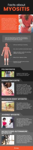 Myositis: Causes & Symptoms of Autoimmune Muscle Diseases - Dr. Axe