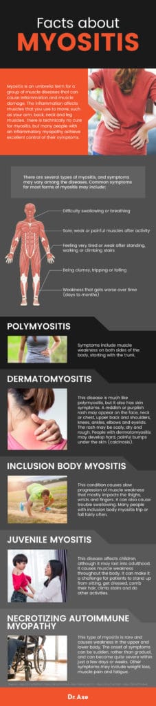 Myositis: Causes & Symptoms of Autoimmune Muscle Diseases - Dr. Axe