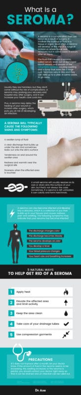 Seroma (+ 5 Natural Seroma Treatment Options) - Dr. Axe