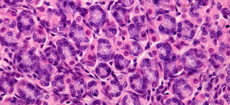 Pepsin: Signs You Need This Vital Enzyme and How to Get It - Dr. Axe