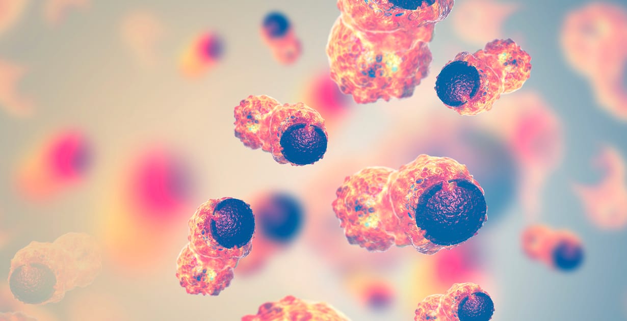 Top 5 Cancer Stem Cell-Killing Foods (From a Pioneering MD) - Dr. Axe