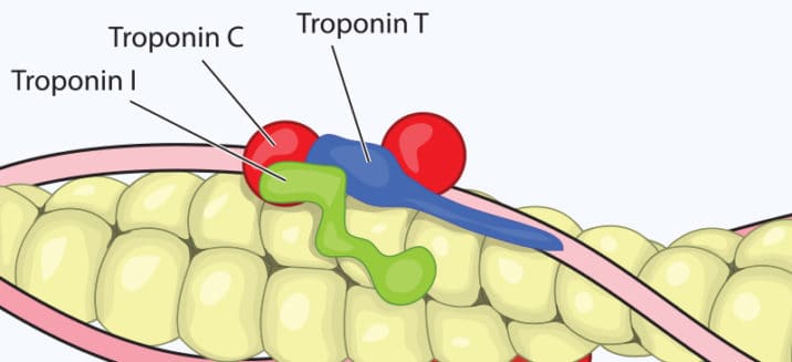 How to Maintain Normal Troponin Levels