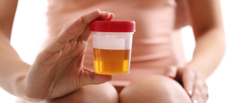 Pee: What Your Urine Color Means for Your Health - Dr. Axe