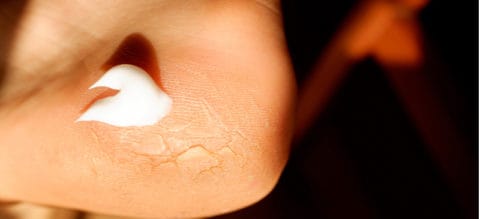 Urea Cream Benefits for Skin, Plus Side Effects - Dr. Axe