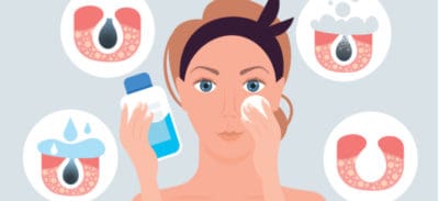 Comedones: Comedonal Acne Symptoms, Treatments, More - Dr. Axe