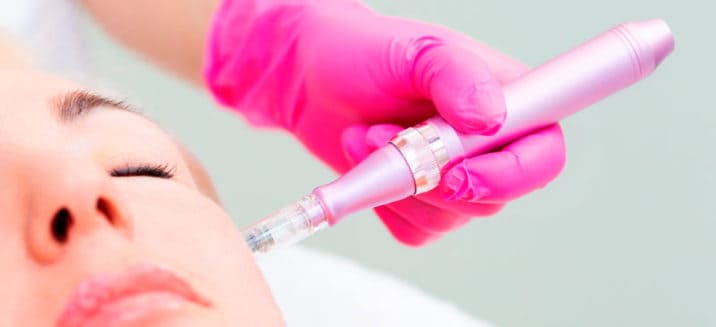 Microneedling Benefits for the Skin and Side Effects - Dr. Axe